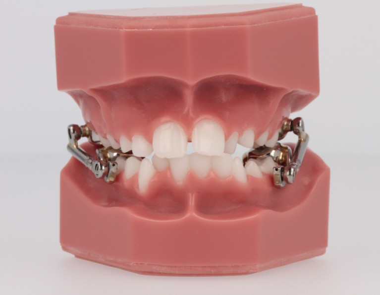 Virtual Product Library | American Orthodontics