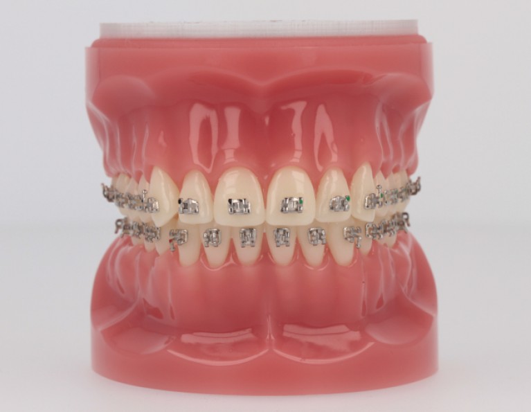 Virtual Product Library | American Orthodontics