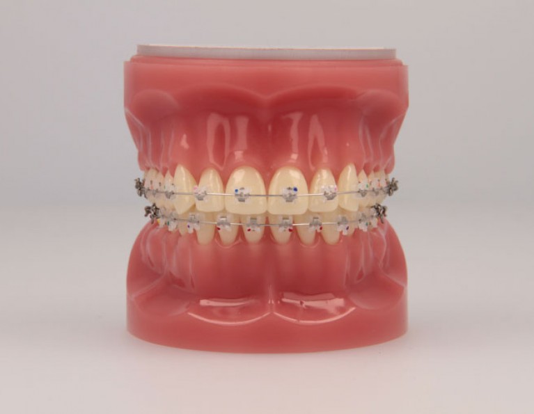 Virtual Product Library | American Orthodontics