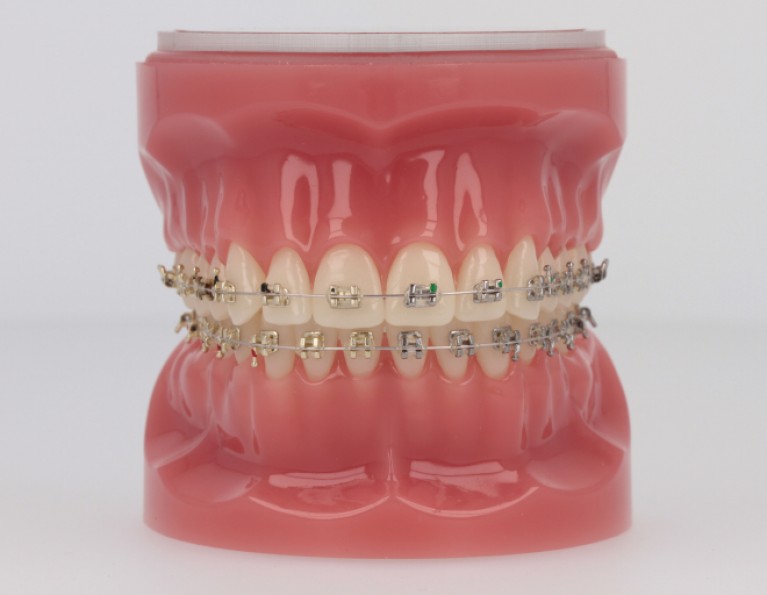 Virtual Product Library | American Orthodontics
