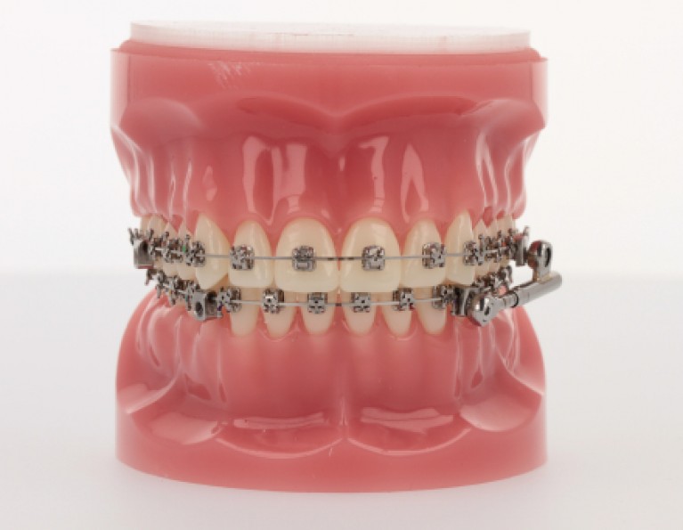 Virtual Product Library | American Orthodontics