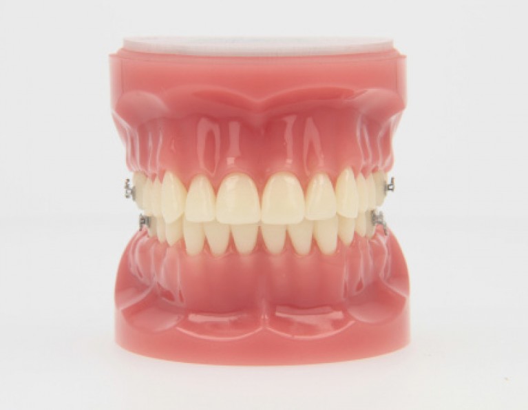 Virtual Product Library | American Orthodontics