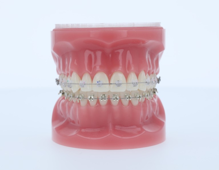Virtual Product Library | American Orthodontics