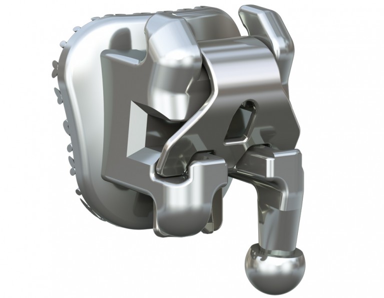 Self Ligating Brackets | American Orthodontics