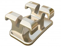 Iconix® Aesthetic Braces | American Orthodontics